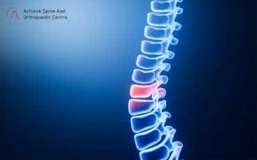 Bulging vs Herniated Disc: Key Differences | Achieve Spine